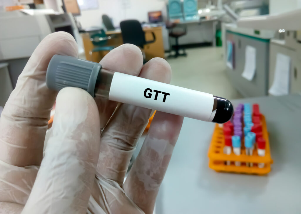 TTGO - CEL MAI IMPORTANT INSTRUMENT DE DEPISTARE A DIABETULUI - Eliza Mirea